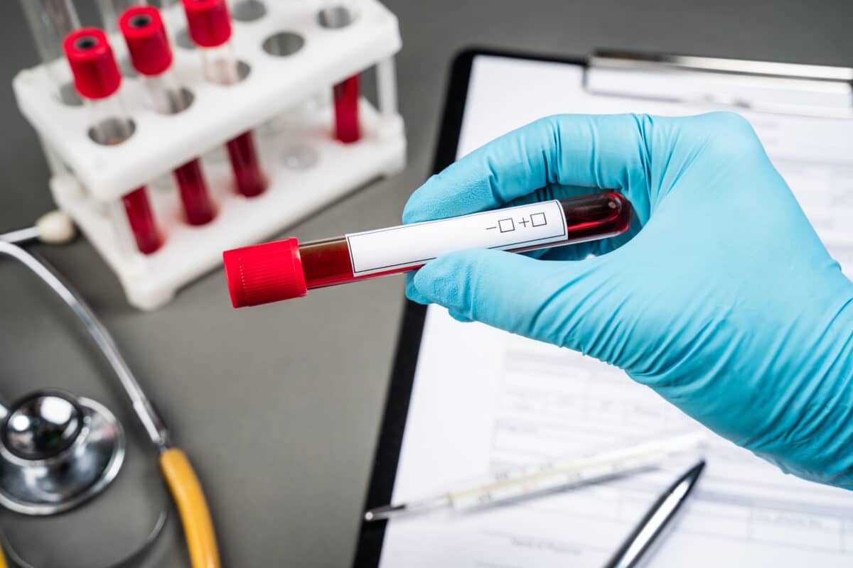 MCHC Blood Test: Understanding Mean Corpuscular Hemoglobin ...