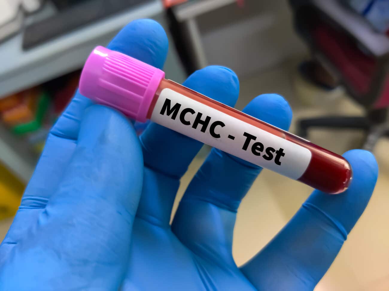 MCHC Blood Test: Understanding Mean Corpuscular Hemoglobin ...