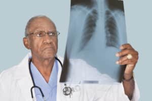 Multifocal Pneumonia: Diagnosis, Management, and Prevention - BDO Pro
