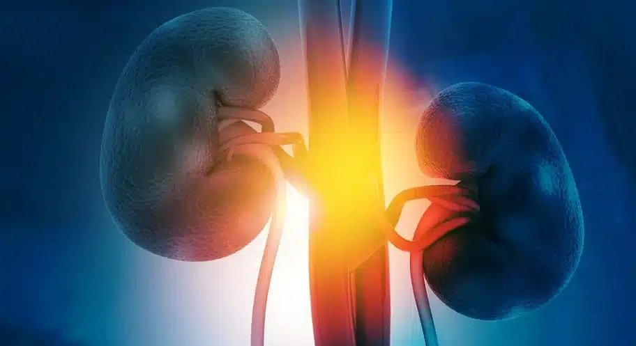 ASN: Expanding Kidney Transplant Wait List Criteria to Include Risk for ...